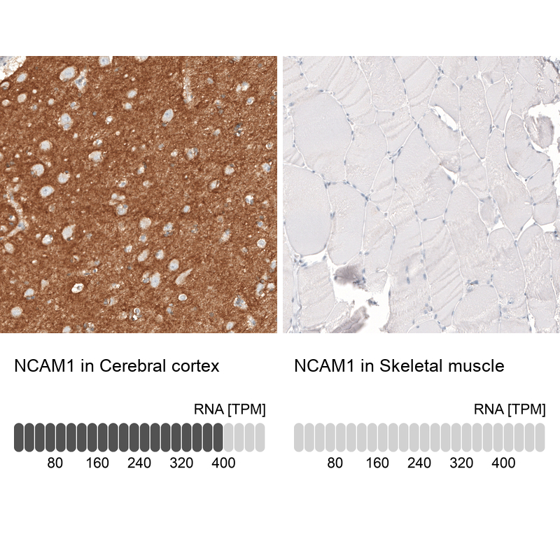 Mouse Monoclonal Anti-NCAM1 Antibody - Buy for research - Highly ...