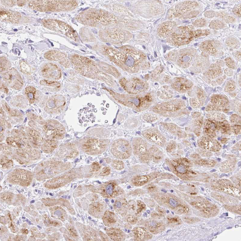 Rabbit Polyclonal Anti-ITPK1 Antibody - Buy for research - Highly ...