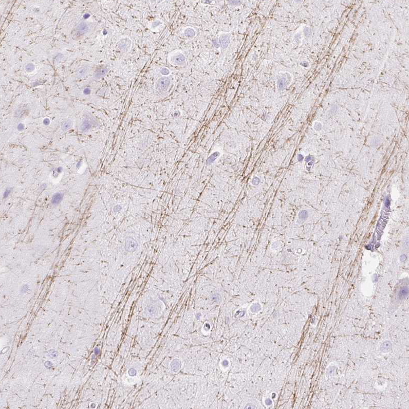 Rabbit Polyclonal Anti-HEXB Antibody - Buy for research - Highly ...