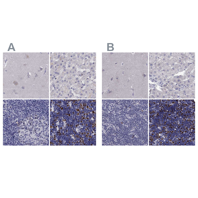 Rabbit Polyclonal Anti-UHRF1 Antibody - Buy for research - Highly specific, rigorously validated ...