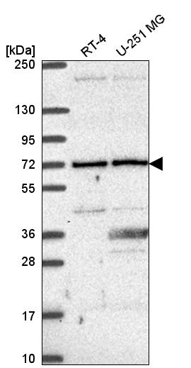 Rabbit Polyclonal Anti-UTP6 Antibody - Buy for research - Highly ...