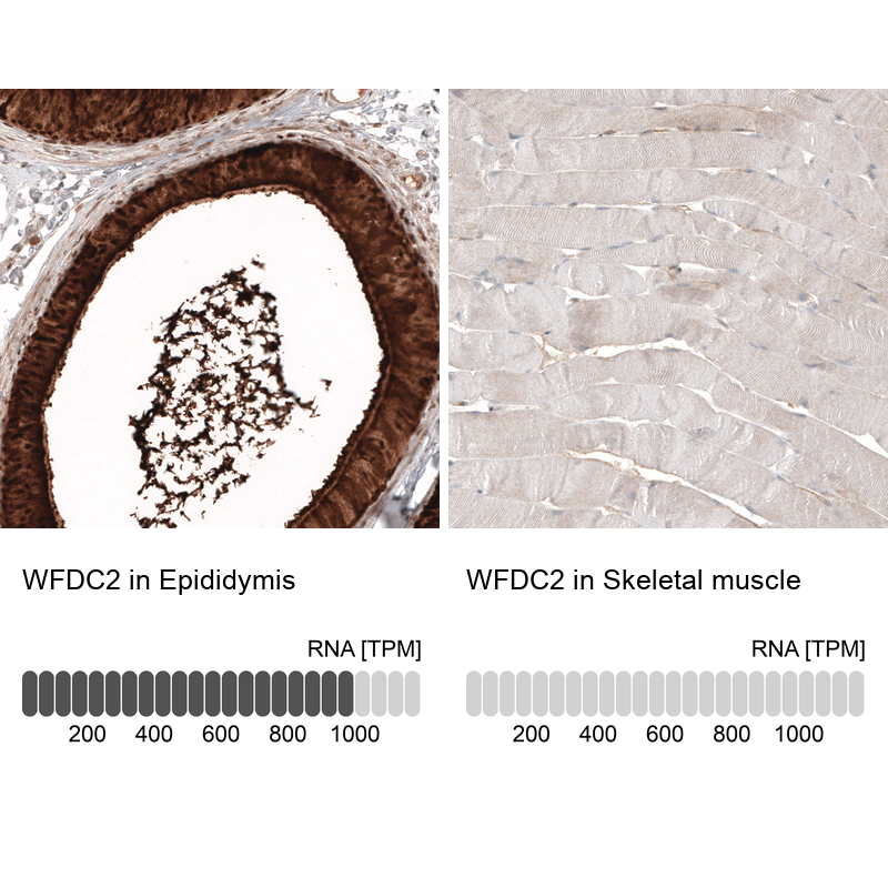 Mouse Monoclonal Anti-WFDC2 Antibody - Buy for research - Highly ...