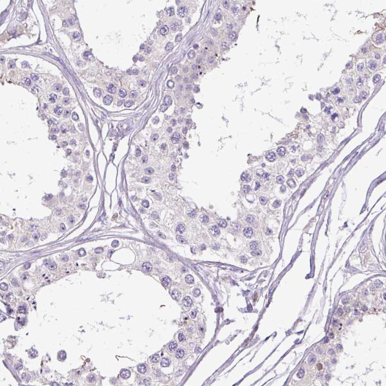 Rabbit Polyclonal Anti-HEXB Antibody - Buy for research - Highly ...