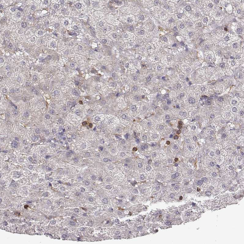Rabbit Polyclonal Anti-PILRA Antibody - Buy for research - Highly ...