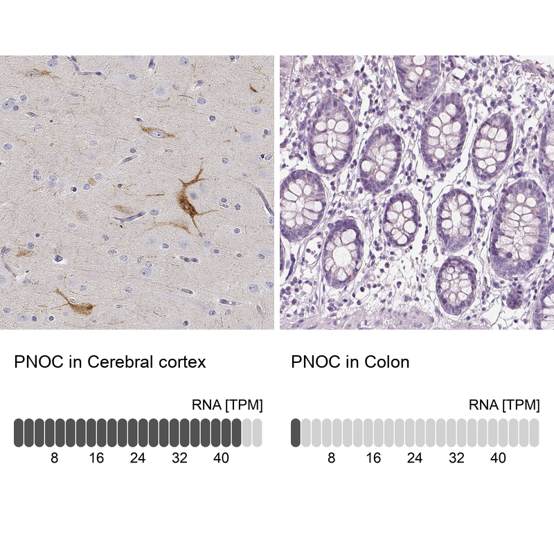 Rabbit Polyclonal Anti-PNOC Antibody - Buy for research - Highly ...