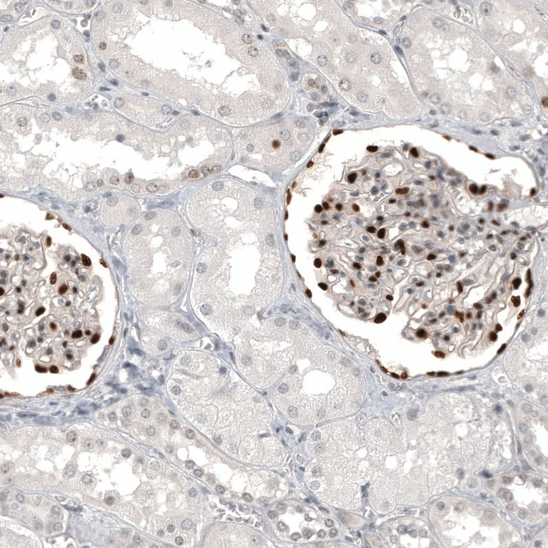 Mouse Monoclonal Anti-WT1 Antibody - Buy for research - Highly specific ...