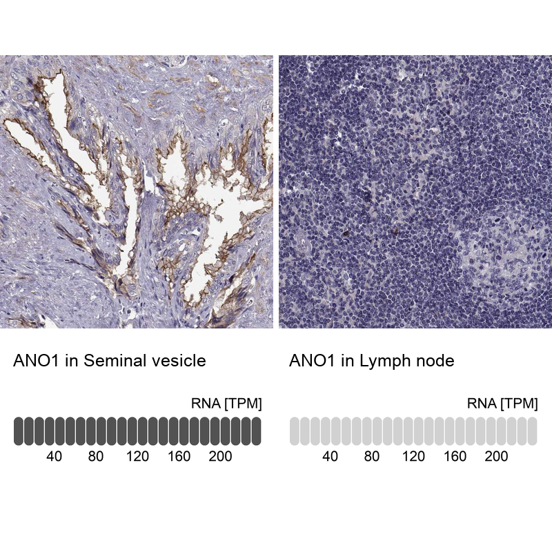 Rabbit Polyclonal Anti-ANO1 Antibody - Buy for research - Highly ...