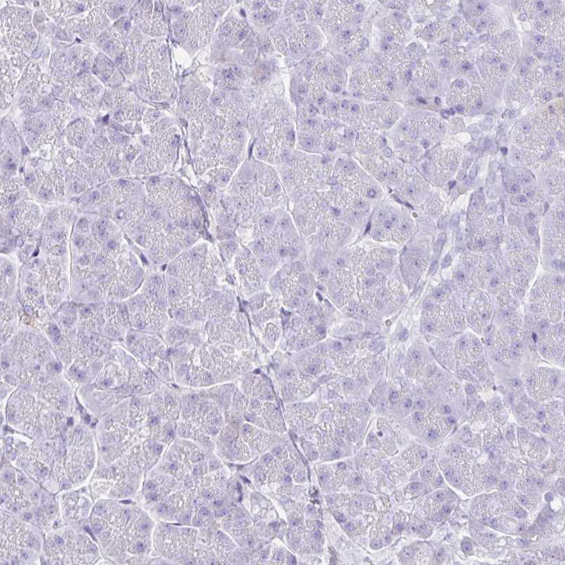 Rabbit Polyclonal Anti-BEST1 Antibody - Buy for research - Highly ...