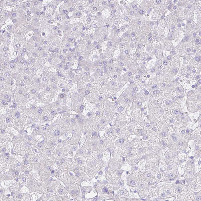 Rabbit Polyclonal Anti-BEST1 Antibody - Buy for research - Highly ...