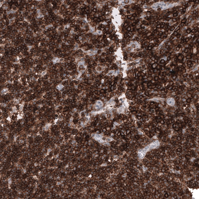 Mouse Monoclonal Anti-CD44 Antibody - Buy for research - Highly ...