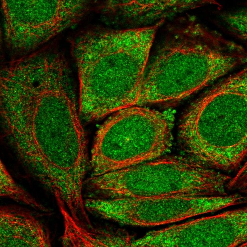 Rabbit Polyclonal Anti-GK5 Antibody - Buy for research - Highly ...