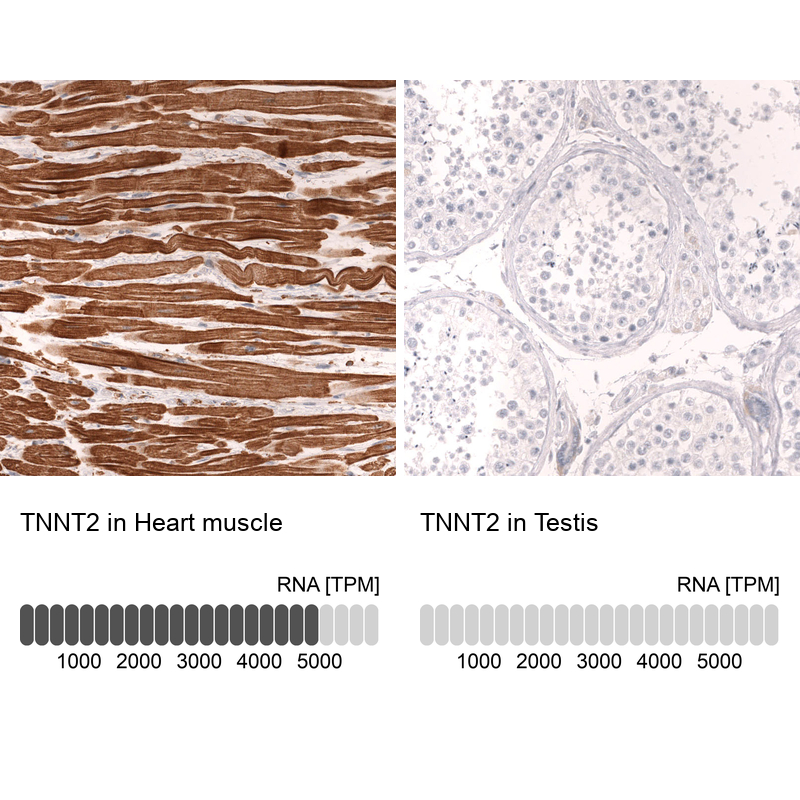 Mouse Monoclonal Anti-TNNT2 Antibody - Buy for research - Highly ...