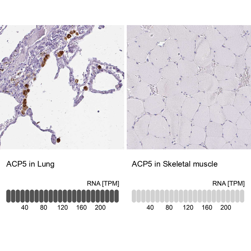 Rabbit Polyclonal Anti-ACP5 Antibody - Buy for research - Highly ...