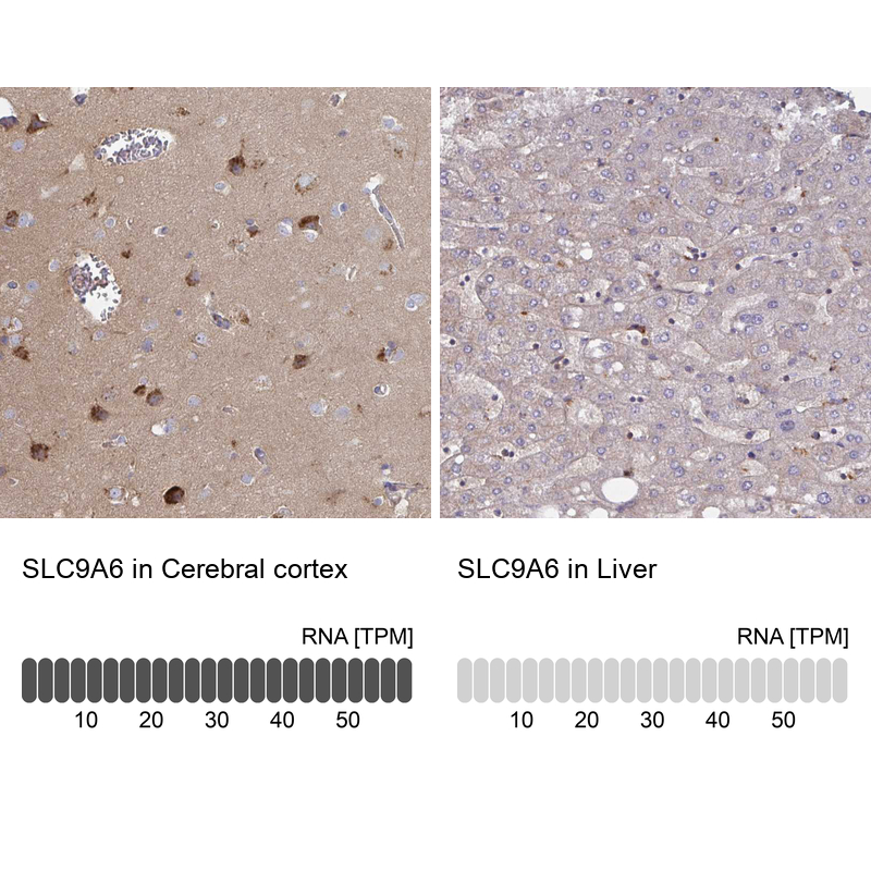 Rabbit Polyclonal Anti-SLC9A6 Antibody - Buy for research - Highly ...