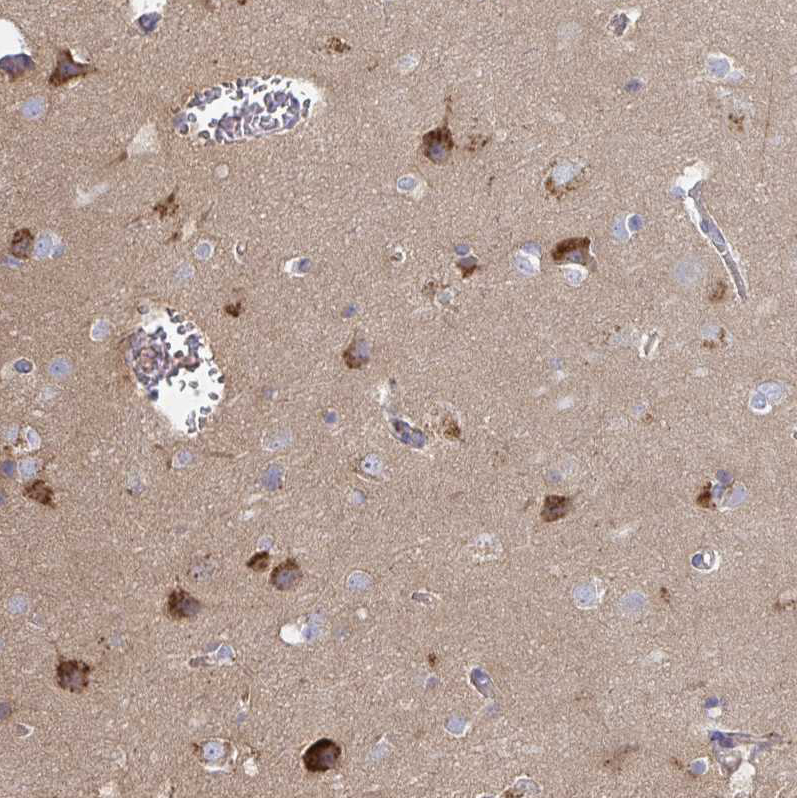 Rabbit Polyclonal Anti-SLC9A6 Antibody - Buy for research - Highly ...