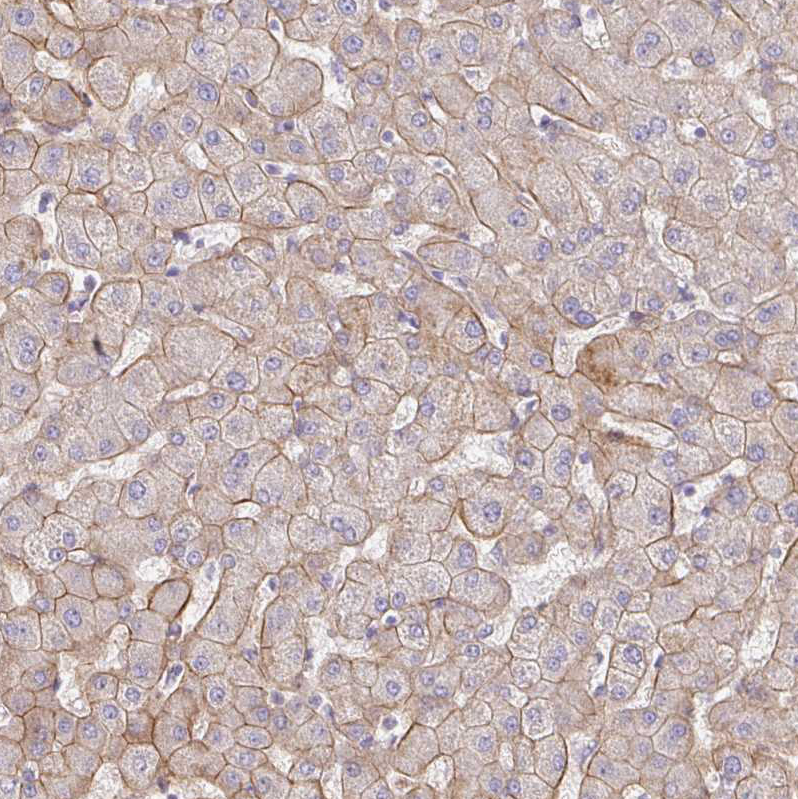 Rabbit Polyclonal Anti-ITGA2 Antibody - Buy for research - Highly ...