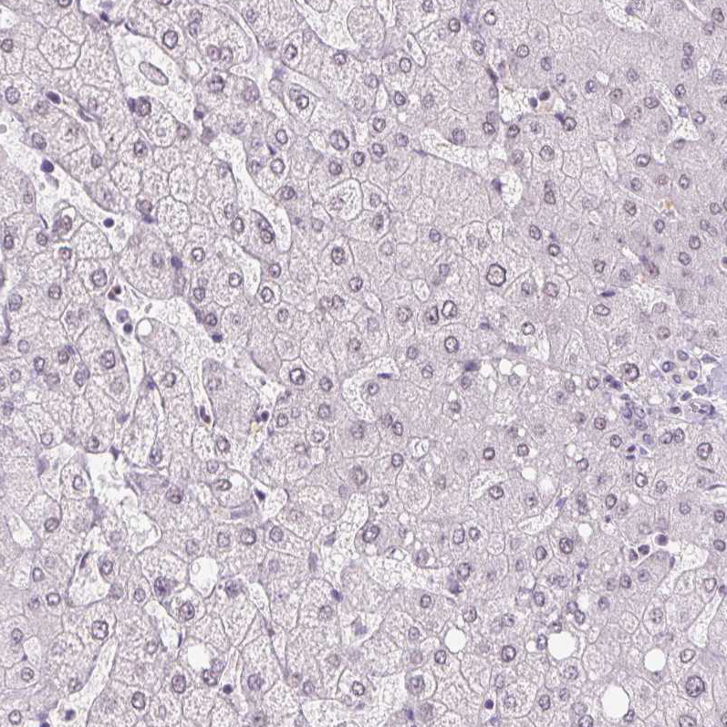 Rabbit Polyclonal Anti-MPO Antibody - Buy for research - Highly ...