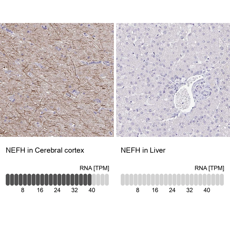 Rabbit Polyclonal Anti-NEFH Antibody - Buy for research - Highly ...