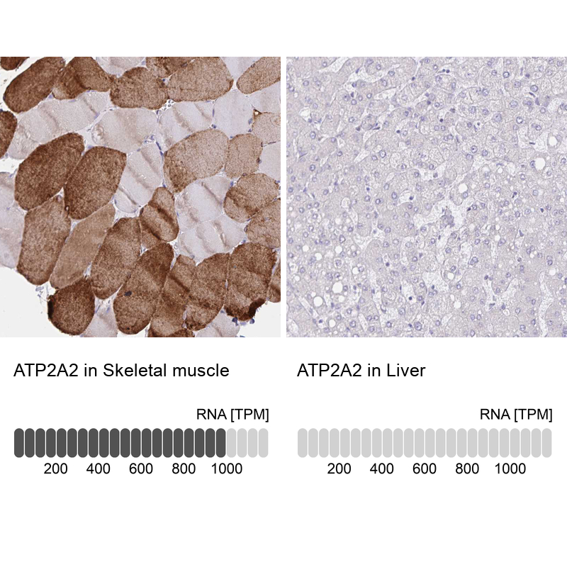 Rabbit Polyclonal Anti-ATP2A2 Antibody - Buy for research - Highly ...