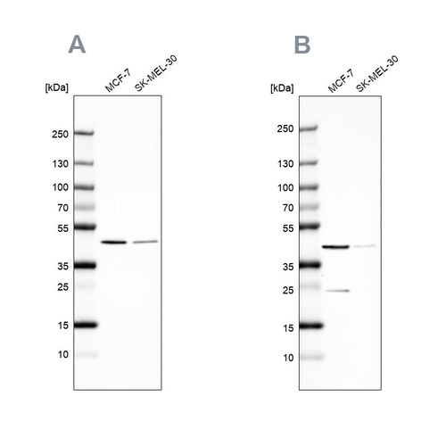Rabbit Polyclonal Anti-DOK7 Antibody - Buy for research - Highly ...
