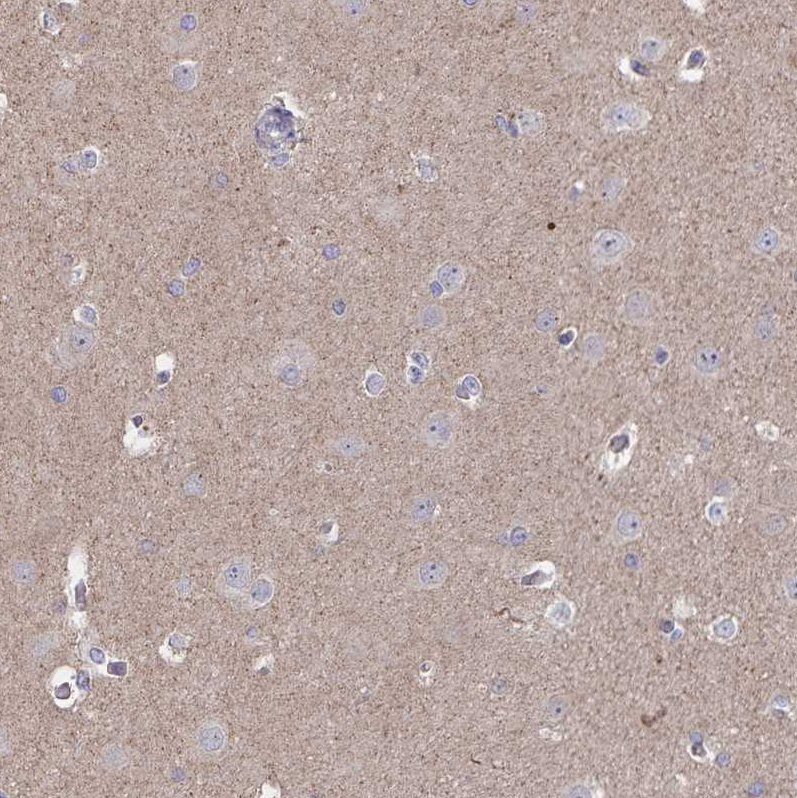 Rabbit Polyclonal Anti-ACACA Antibody - Buy for research - Highly ...