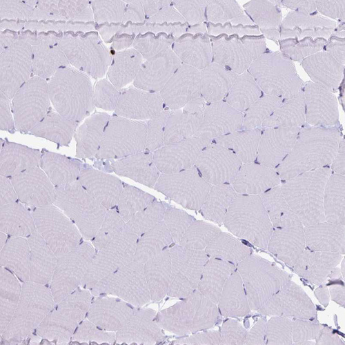 Rabbit Polyclonal Anti-GZMK Antibody - Buy for research - Highly ...