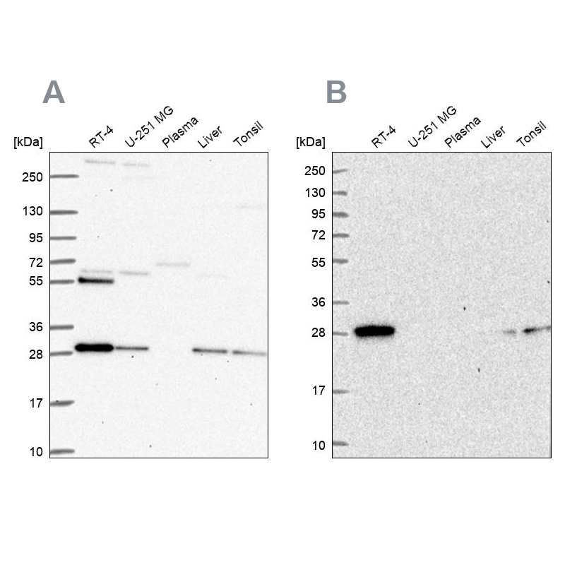 Rabbit Polyclonal Anti-PMM2 Antibody - Buy for research - Highly ...