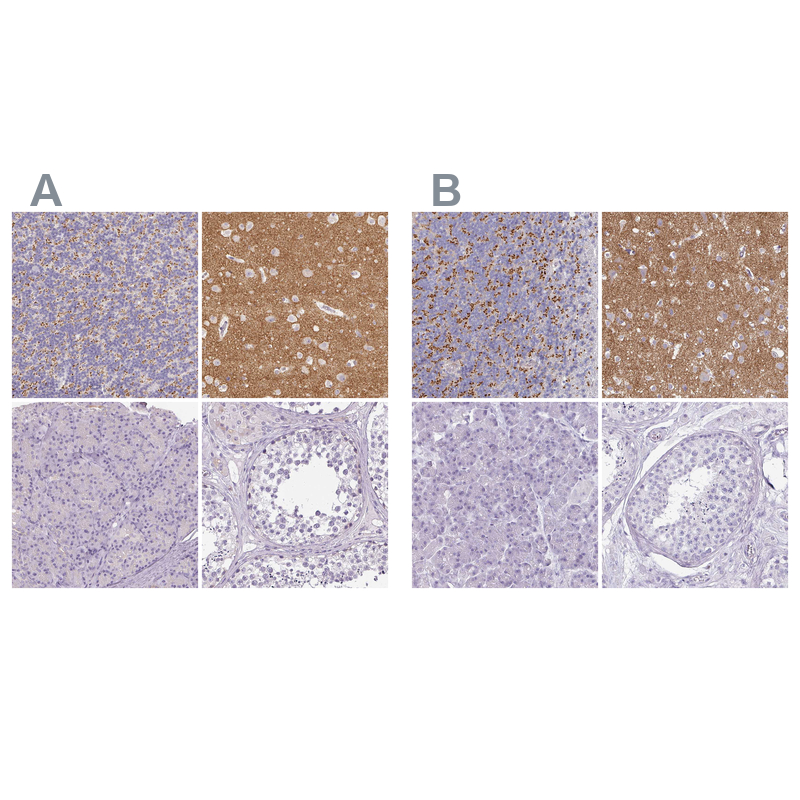 Rabbit Polyclonal Anti-SLC17A7 Antibody - Buy for research - Highly ...