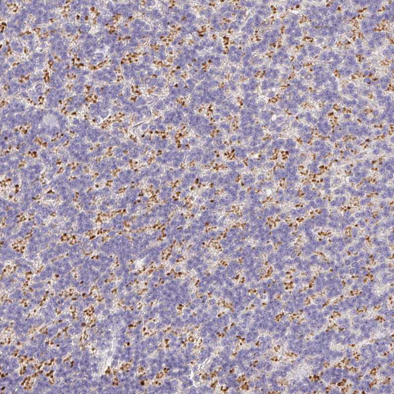 Rabbit Polyclonal Anti-SLC17A7 Antibody - Buy for research - Highly ...