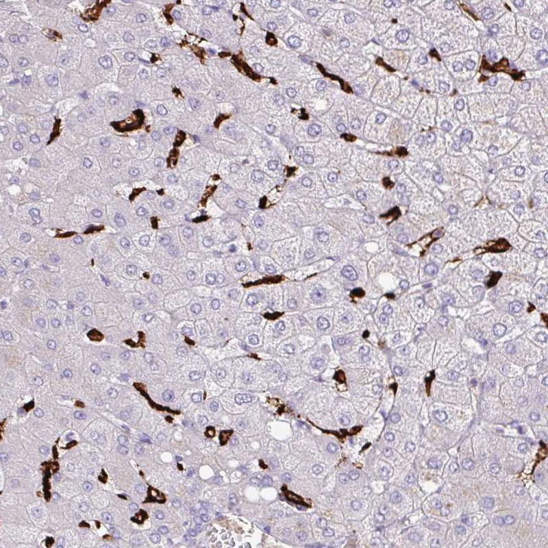 Rabbit Polyclonal Anti-MARCO Antibody - Buy for research - Highly ...