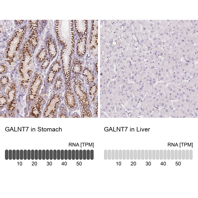 Rabbit Polyclonal Anti-GALNT7 Antibody - Buy for research - Highly ...