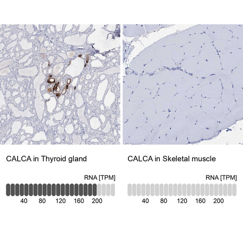 Anti-CALCA Human Protein Atlas Antibody