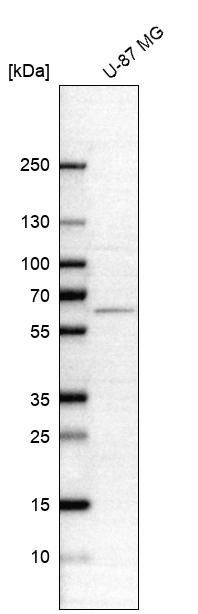 Rabbit Polyclonal Anti-ASNS Antibody - Buy for research - Highly ...