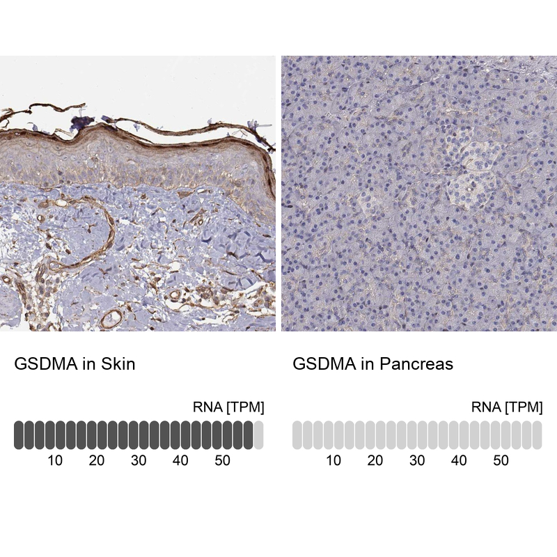 Rabbit Polyclonal Anti-GSDMA Antibody - Buy for research - Highly ...