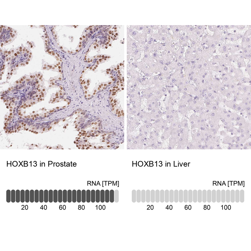 Rabbit Polyclonal Anti-HOXB13 Antibody - Buy for research - Highly ...