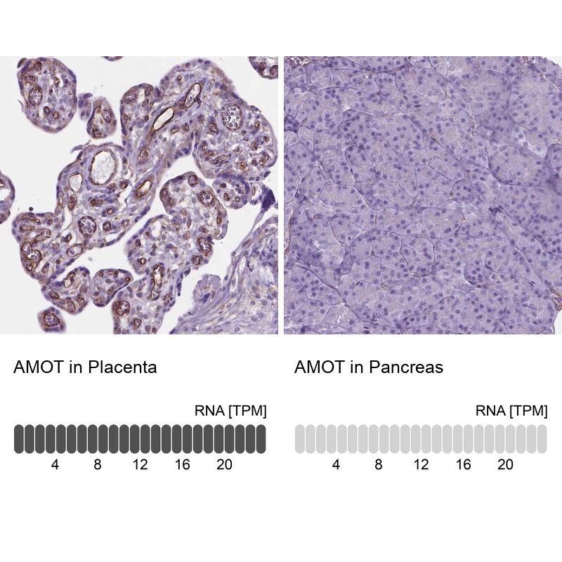 Rabbit Polyclonal Anti-AMOT Antibody - Buy for research - Highly ...