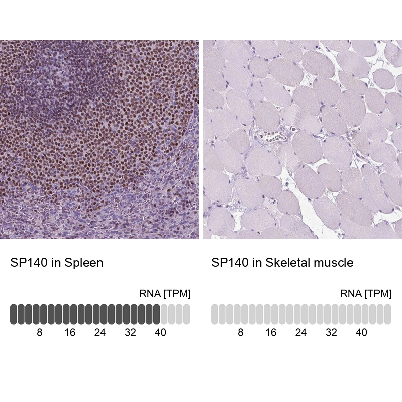 Rabbit Polyclonal Anti-SP140 Antibody - Buy for research - Highly ...