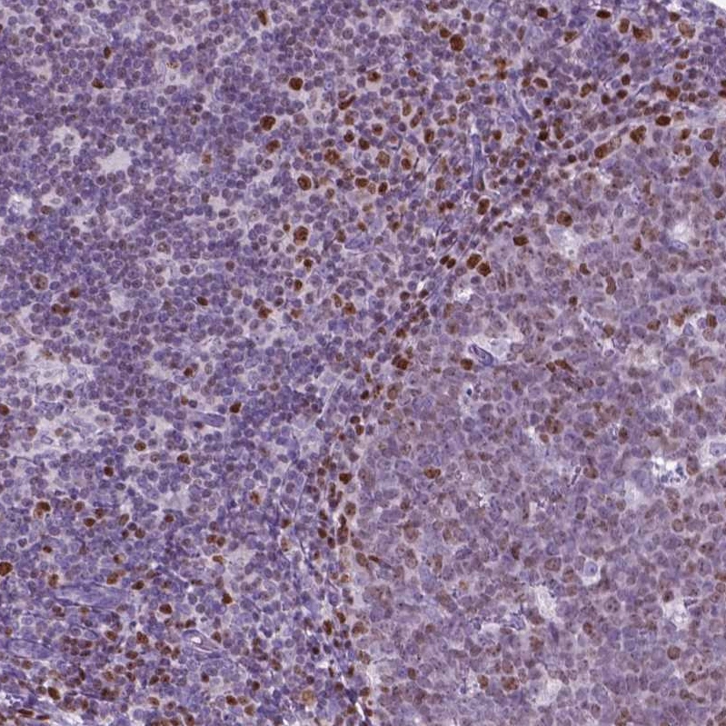 Rabbit Polyclonal Anti-SP140 Antibody - Buy for research - Highly ...