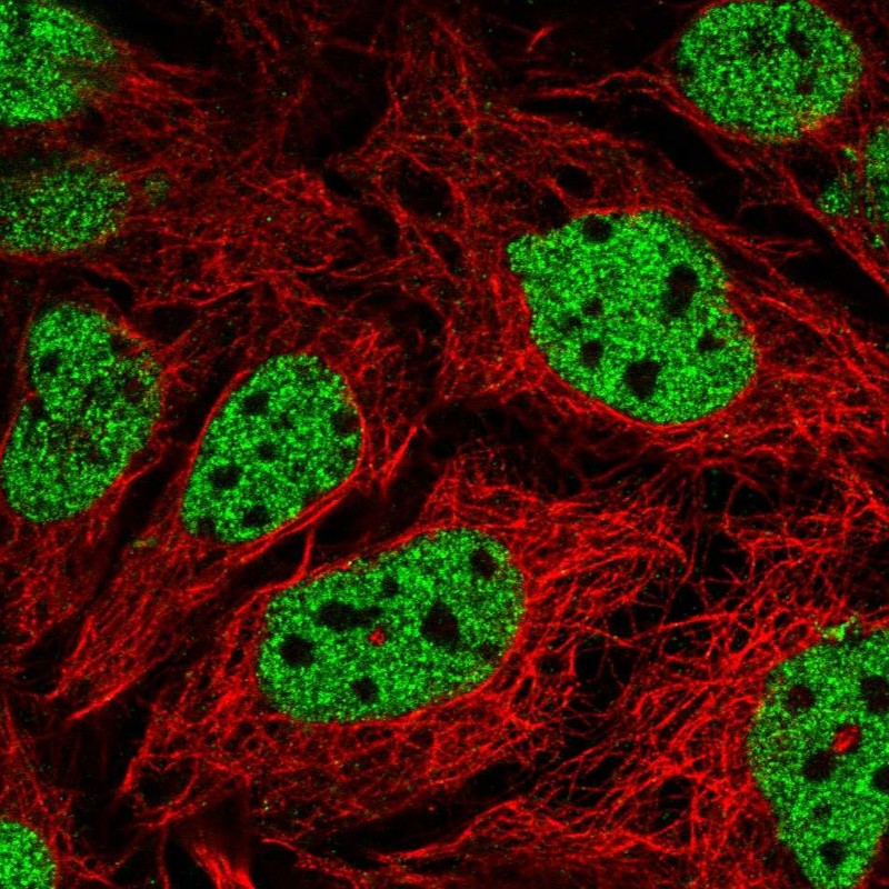 Rabbit Polyclonal Anti-GPS2 Antibody - Buy for research - Highly specific, rigorously validated ...