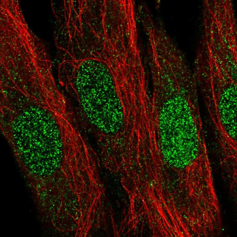Rabbit Polyclonal Anti-LDB2 Antibody - Buy for research - Highly ...
