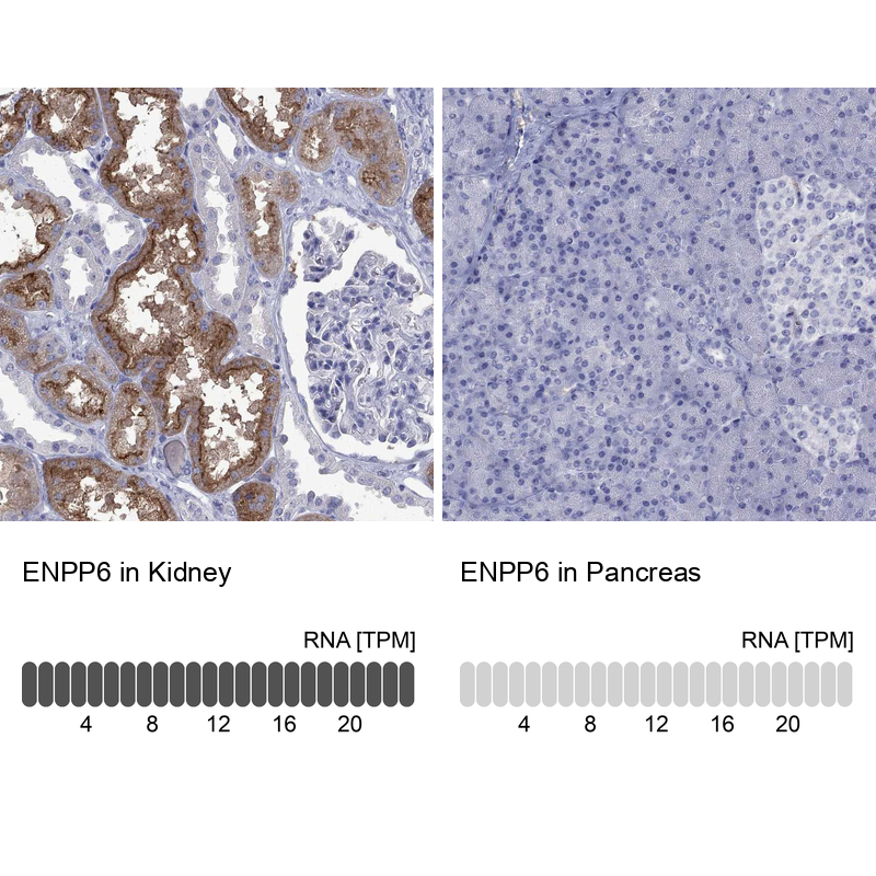 Rabbit Polyclonal Anti-ENPP6 Antibody - Buy for research - Highly ...