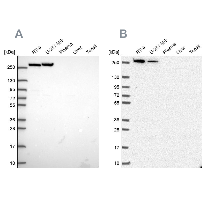 Rabbit Polyclonal Anti-CAD Antibody - Buy for research - Highly ...
