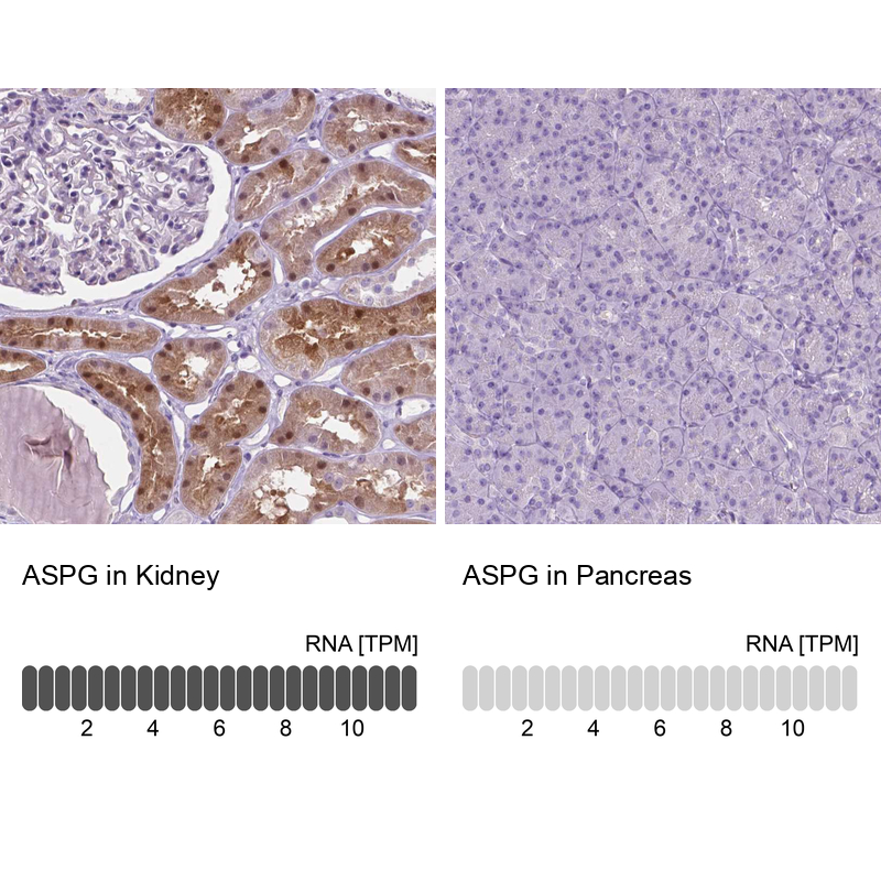 Rabbit Polyclonal Anti-ASPG Antibody - Buy for research - Highly specific, rigorously validated ...