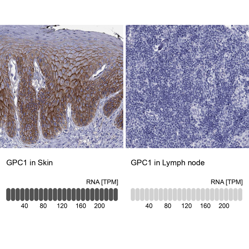 Rabbit Polyclonal Anti-GPC1 Antibody - Buy for research - Highly specific, rigorously validated ...