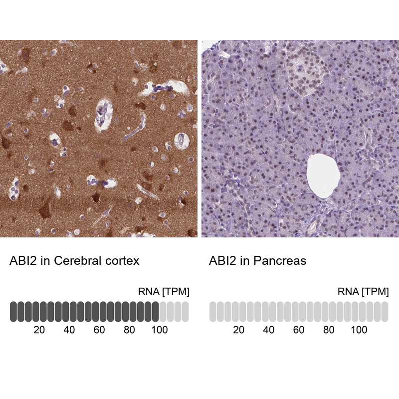 Rabbit Polyclonal Anti-ABI2 Antibody - Buy for research - Highly specific, rigorously validated ...