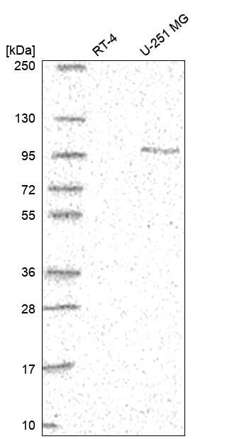 Rabbit Polyclonal Anti-DLG4 Antibody - Buy for research - Highly ...