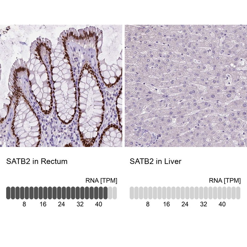 Mouse Monoclonal Anti-SATB2 Antibody - Buy for research - Highly ...