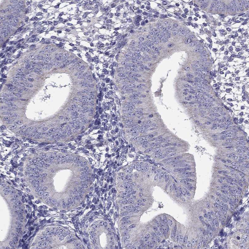 Rabbit Polyclonal Anti-DSC1 Antibody - Buy for research - Highly ...