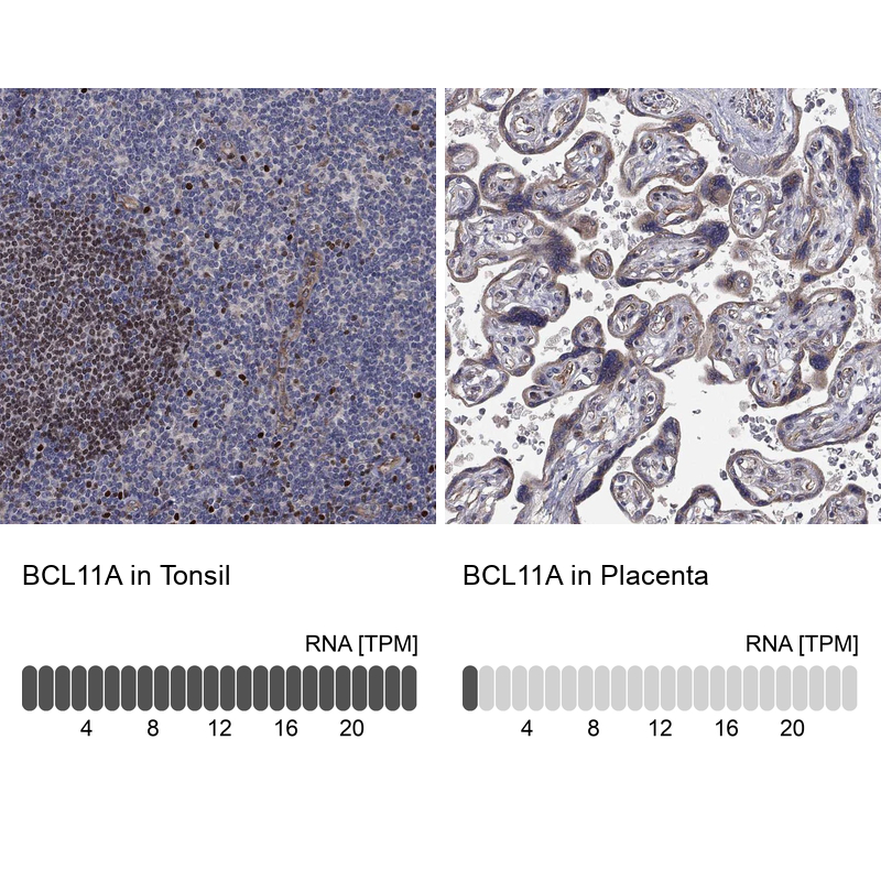 Rabbit Polyclonal Anti-BCL11A Antibody - Buy for research - Highly ...