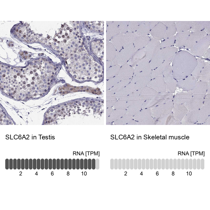 Rabbit Polyclonal Anti-SLC6A2 Antibody - Buy for research - Highly ...